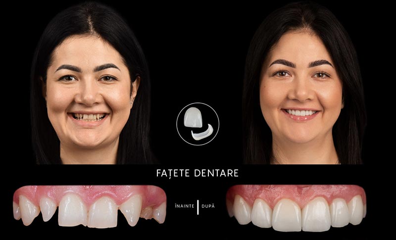 DentusDentino – Centrul Stomatologic DentusDentino
